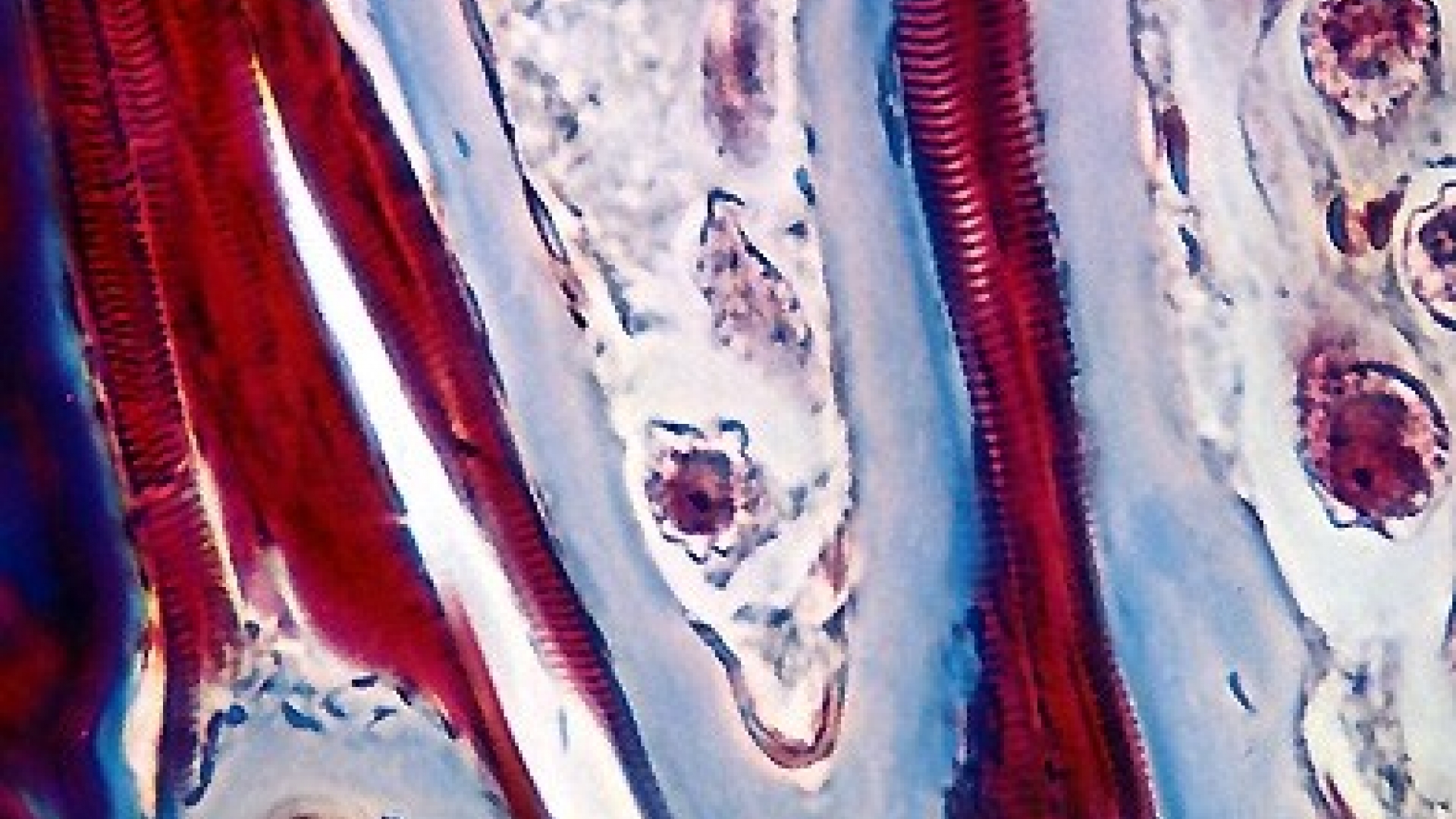 Trichine aus dem Lexikon | wissen.de
