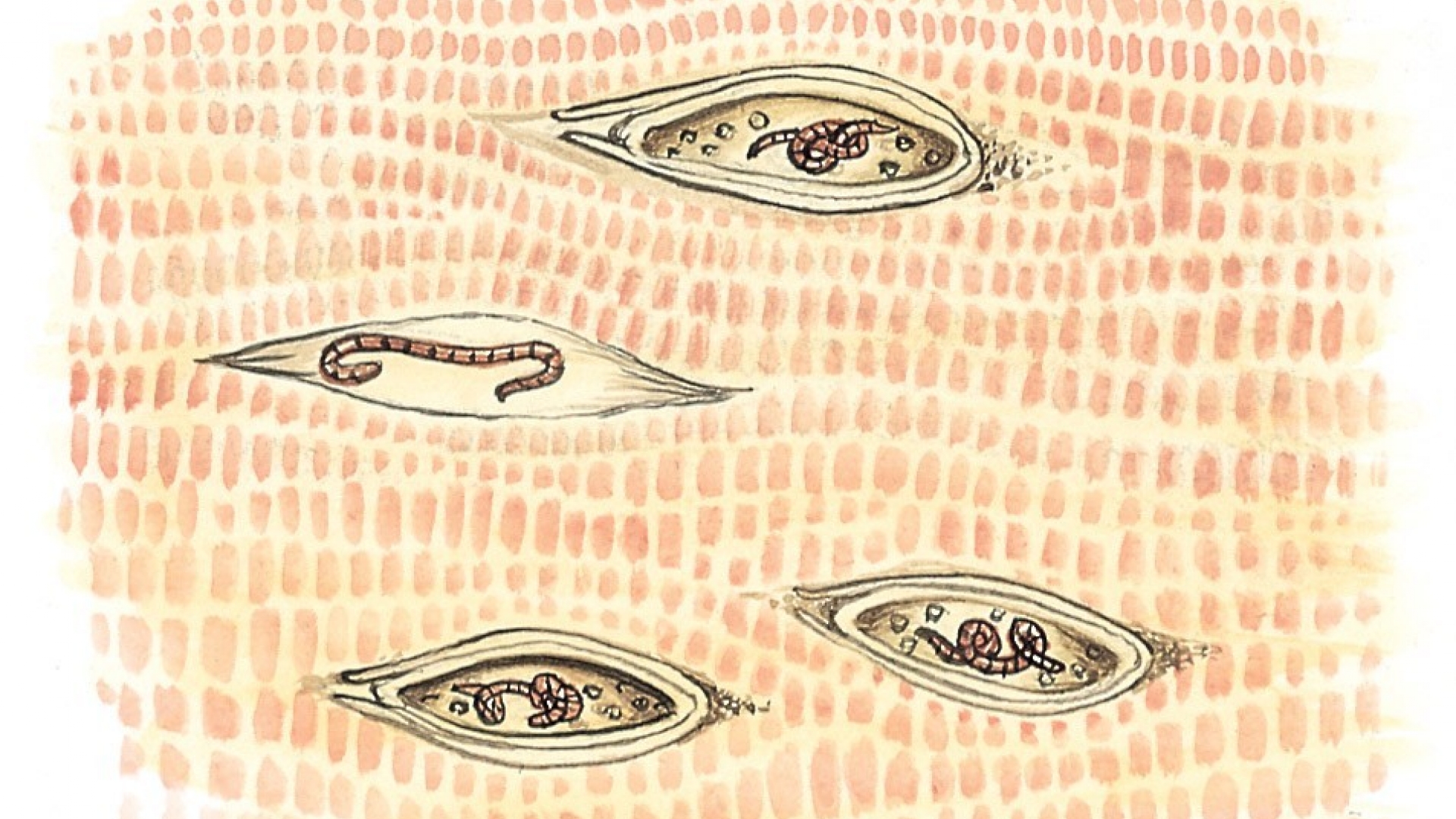 Trichine | wissen.de
