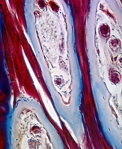 Trichine aus dem Lexikon | wissen.de