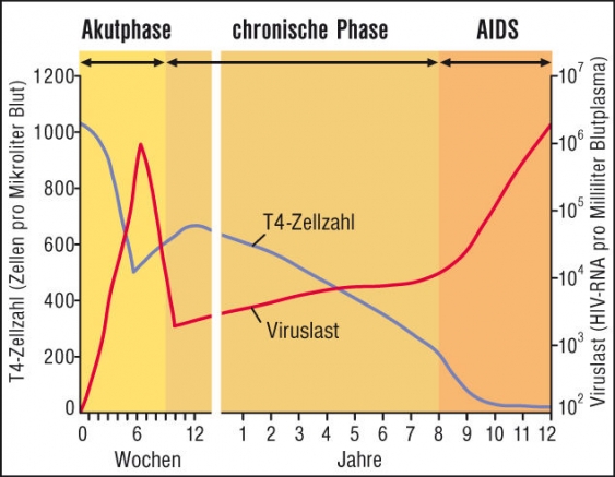 Aids aus dem Lexikon | wissen.de