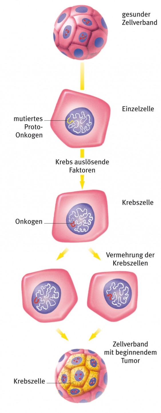 Krebs, aus dem Gesundheitslexikon | Gesundheit, Medizin und Heilkunde ...