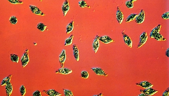 Protozoen aus dem Lexikon | wissen.de